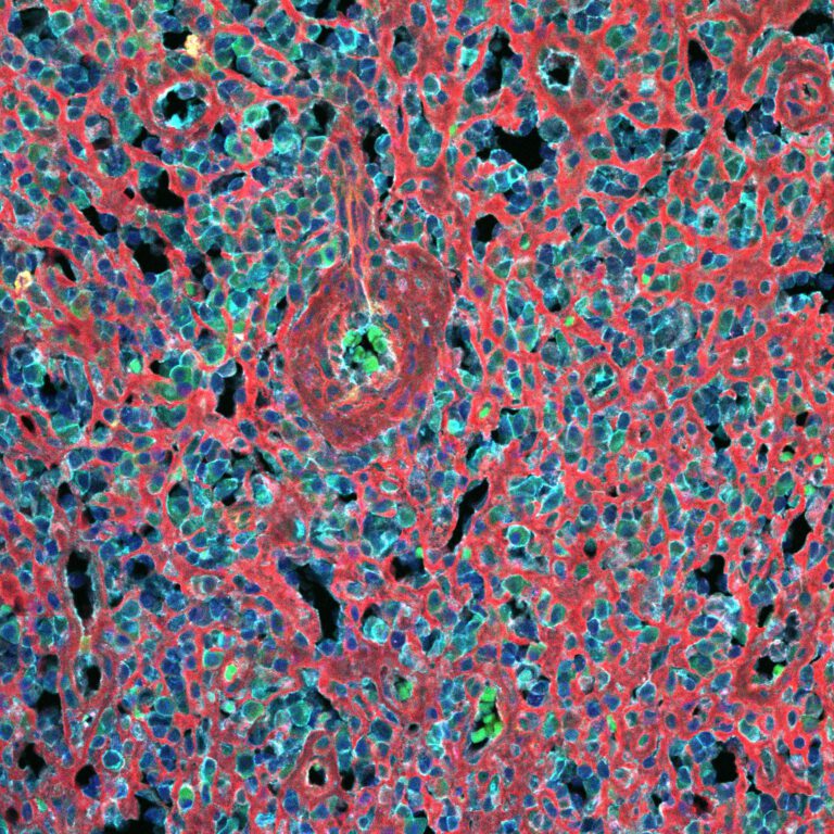 Research – Hernando Lab